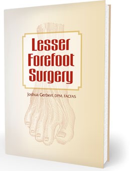 Lesser Forefoot Surgery